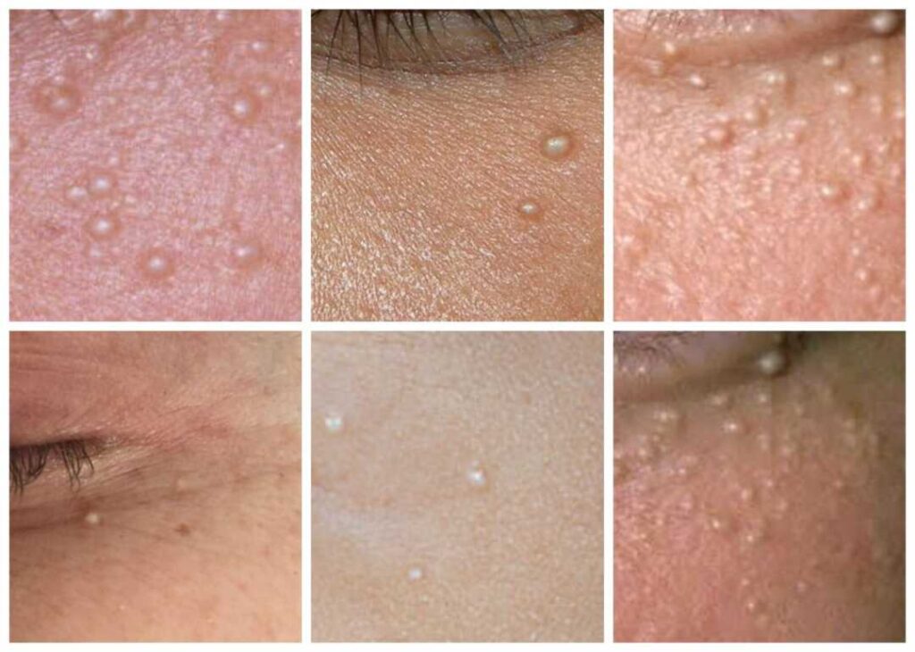 Pele do recém-nascido: o que você precisa saber - Pediatria Descomplicada